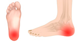 Bolest paty (plantární fasciitis)